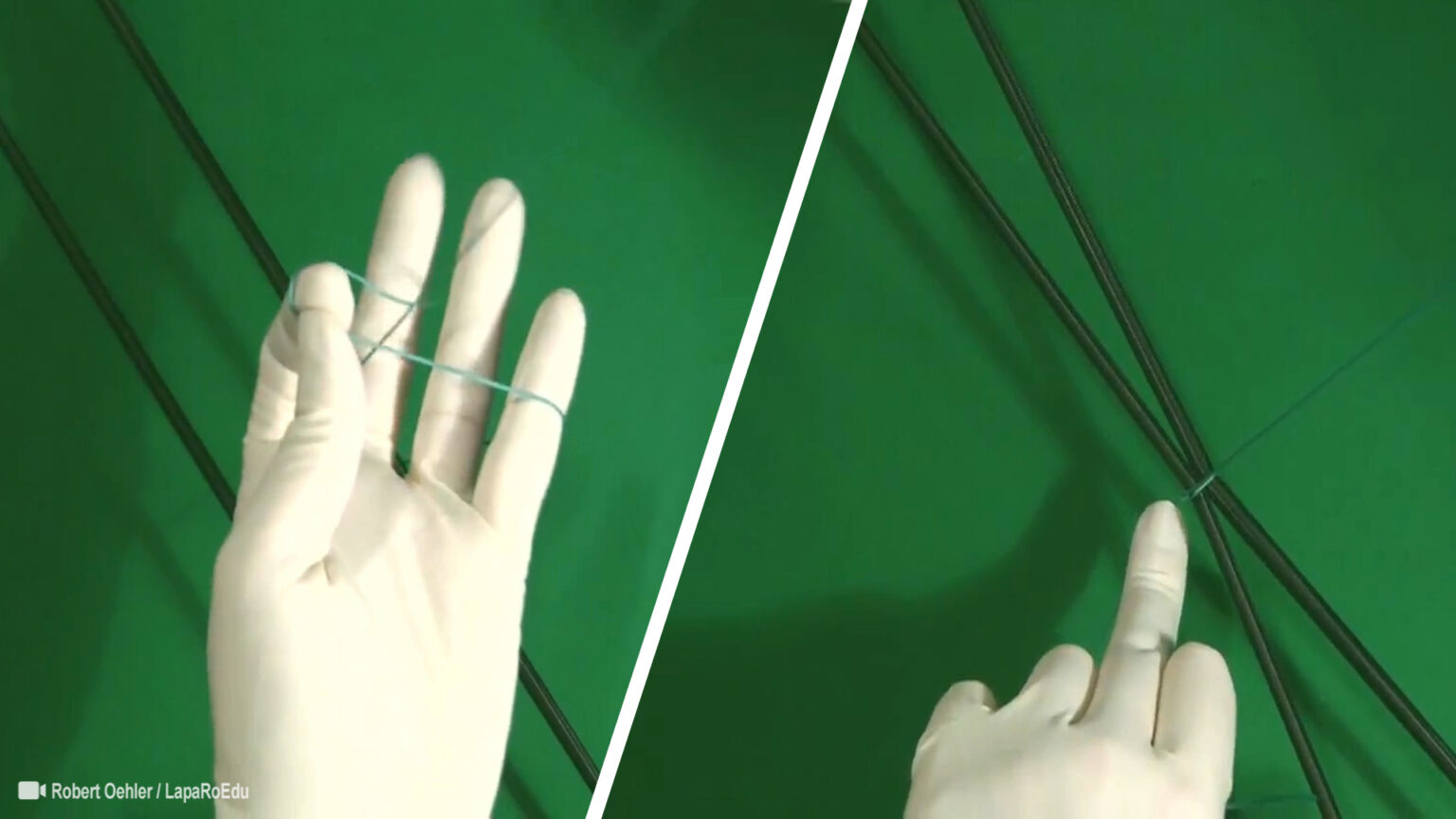 How to Make a Slip Knot? - GynecolOncol