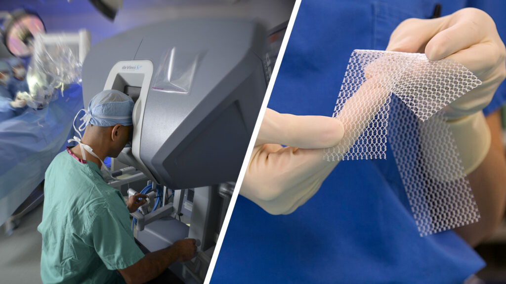 Robotic Ventral Hernia Repair with Mesh Placement - GynecolOncol