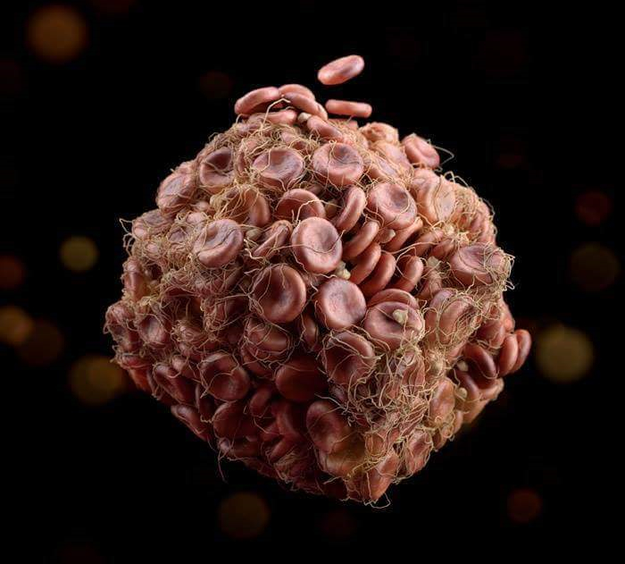 Understanding Mean Platelet Volume (MPV) Blood Test: High MPV, Low MPV ...