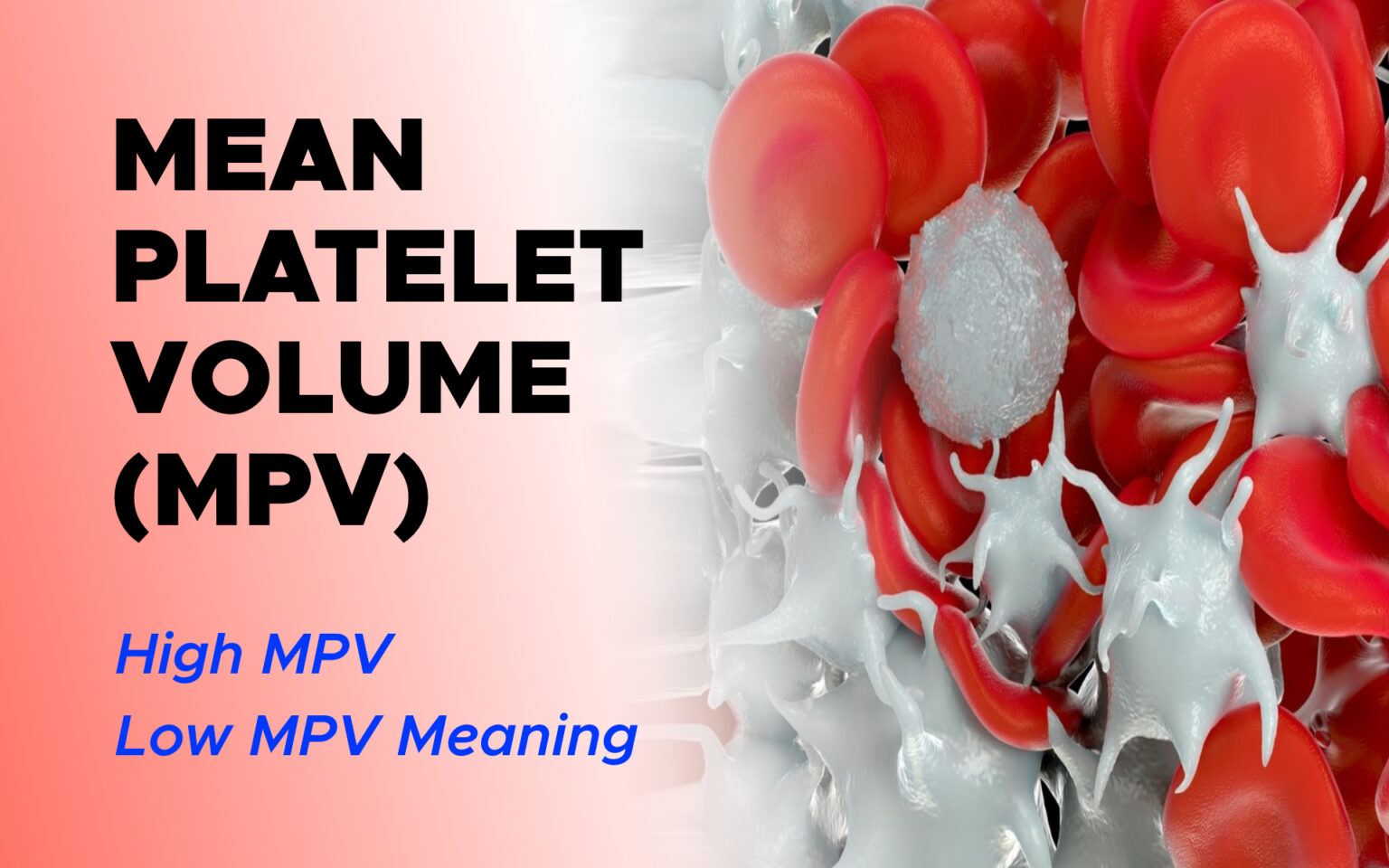 Understanding Mean Platelet Volume MPV Blood Test High MPV Low MPV