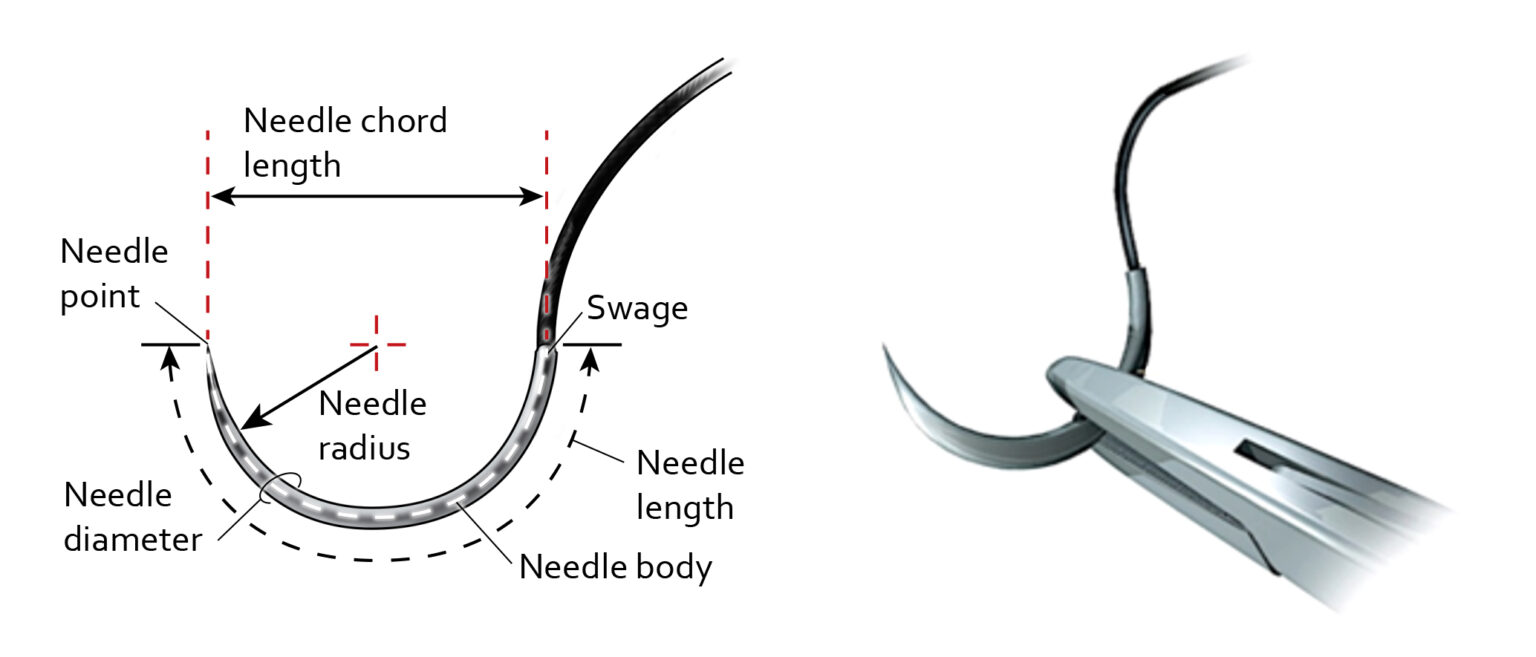 Suture Materials: Suture Size, Absorption Time, Suture Needles and ...